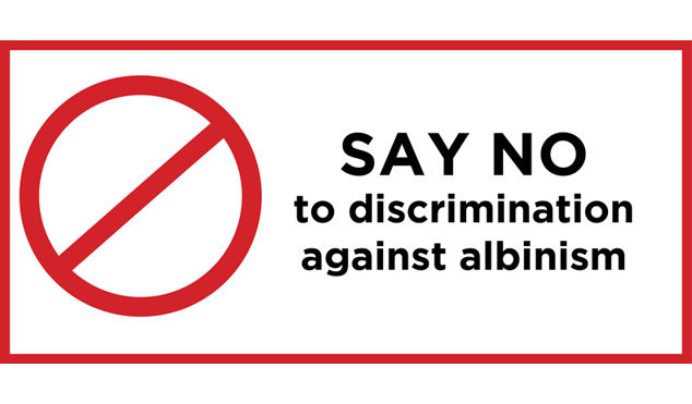 People living with albinism must be treated with respect | Vuk'uzenzele